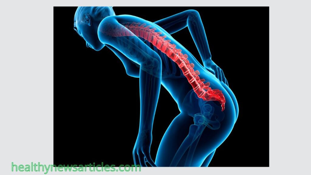 Key Vitamin Deficiencies Causing Your Back Pain - Healthy News Articles