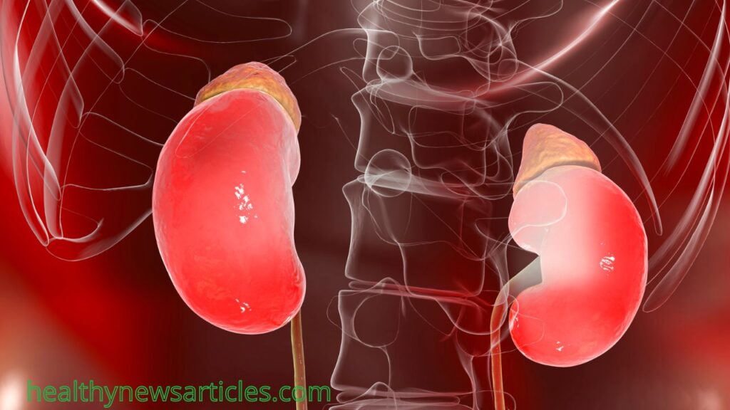 13 Signs and Symptoms of Failing Kidneys
